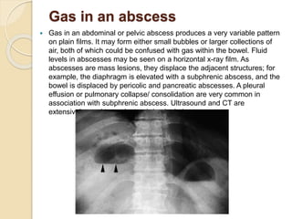 Plain abdomen | PPTX