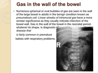 Plain abdomen | PPTX