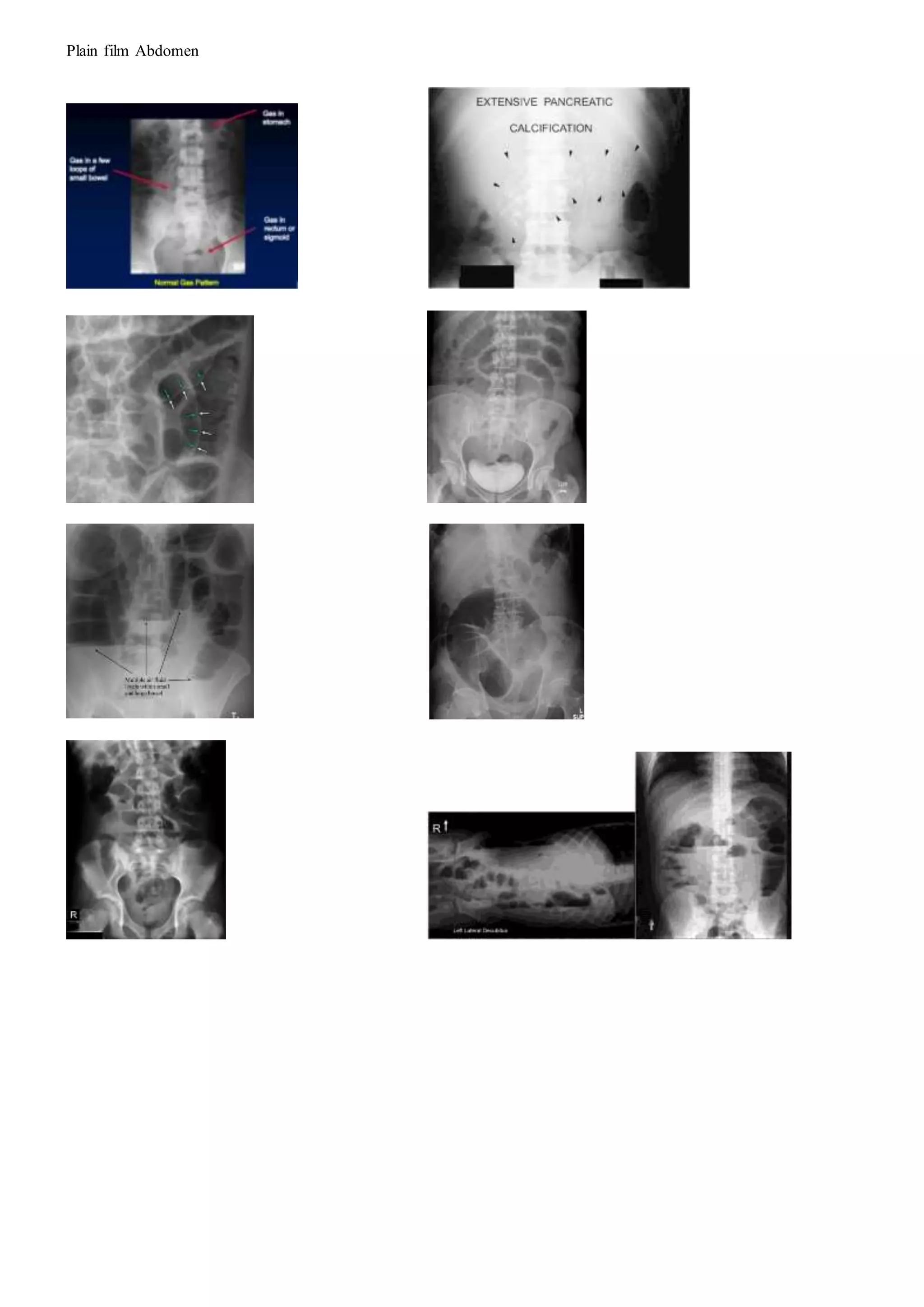 Plain film chest | DOCX