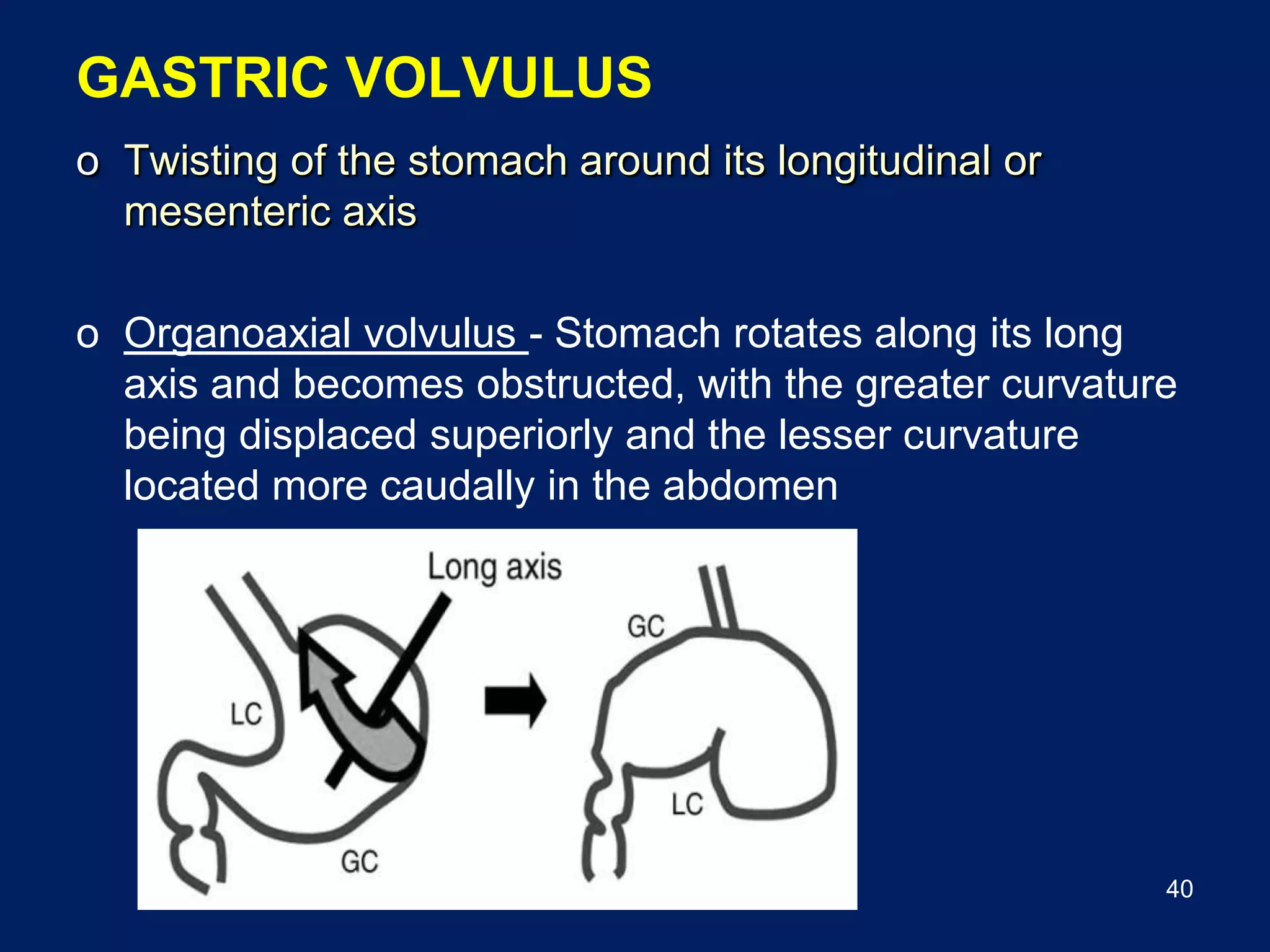 Plain picture in acute abdomen | PPTX