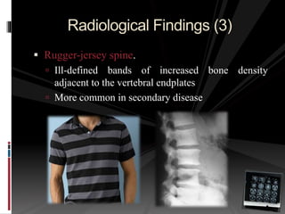 Plain radiological findings of primary hyperparathyrodism | PPTX