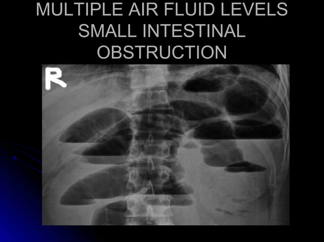 Plain x-ray | PPT