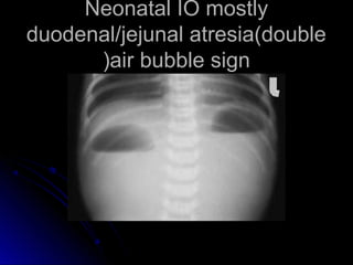 Plain x-ray | PPT