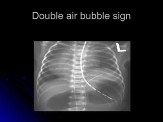 Plain x-ray | PPT