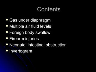 Plain x-ray | PPT