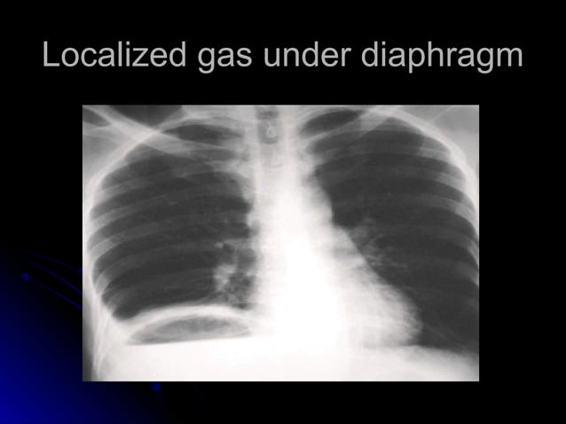 Plain x-ray | PPT