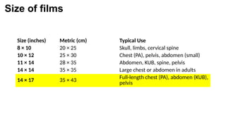 PLAIN XRAY KUB AUG MCU CLASS urology ppt | PPTX
