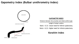 PLAIN XRAY KUB AUG MCU CLASS urology ppt | PPTX