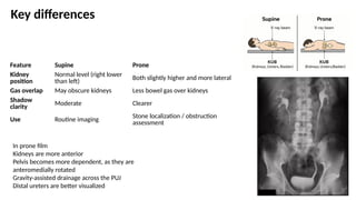 PLAIN XRAY KUB AUG MCU CLASS urology ppt | PPTX