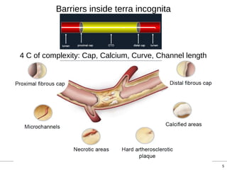 Plan the approach based on the angiogram | PPT