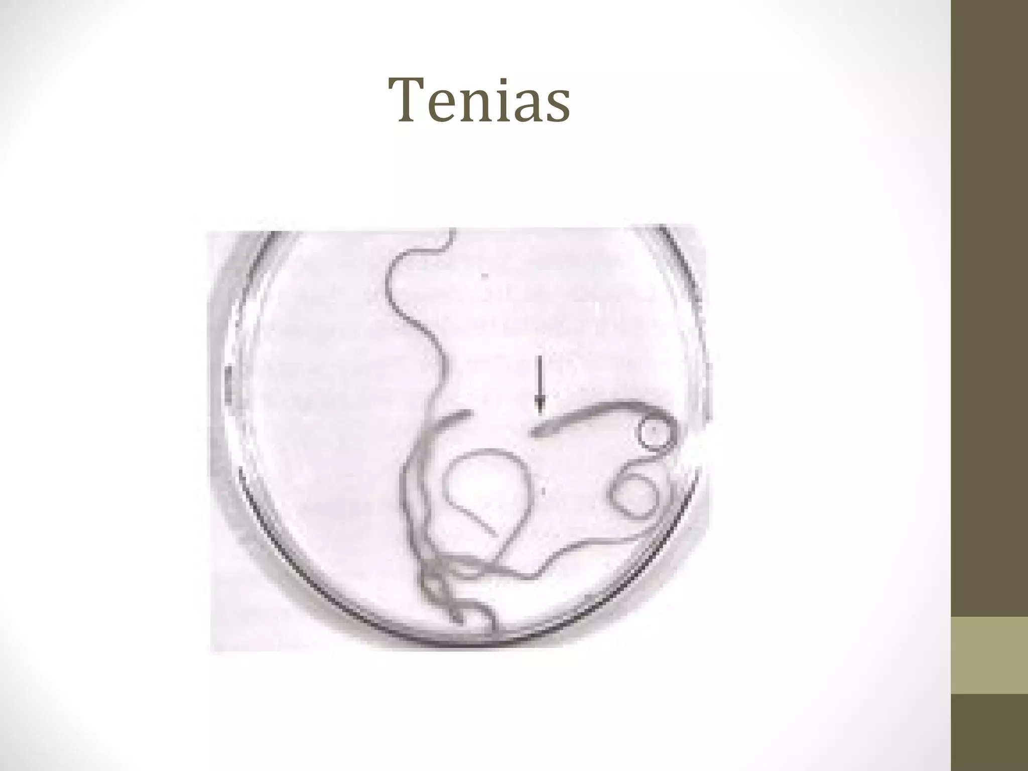 tenia o solitaria | PPT | Reproductive Health | Diseases and Conditions