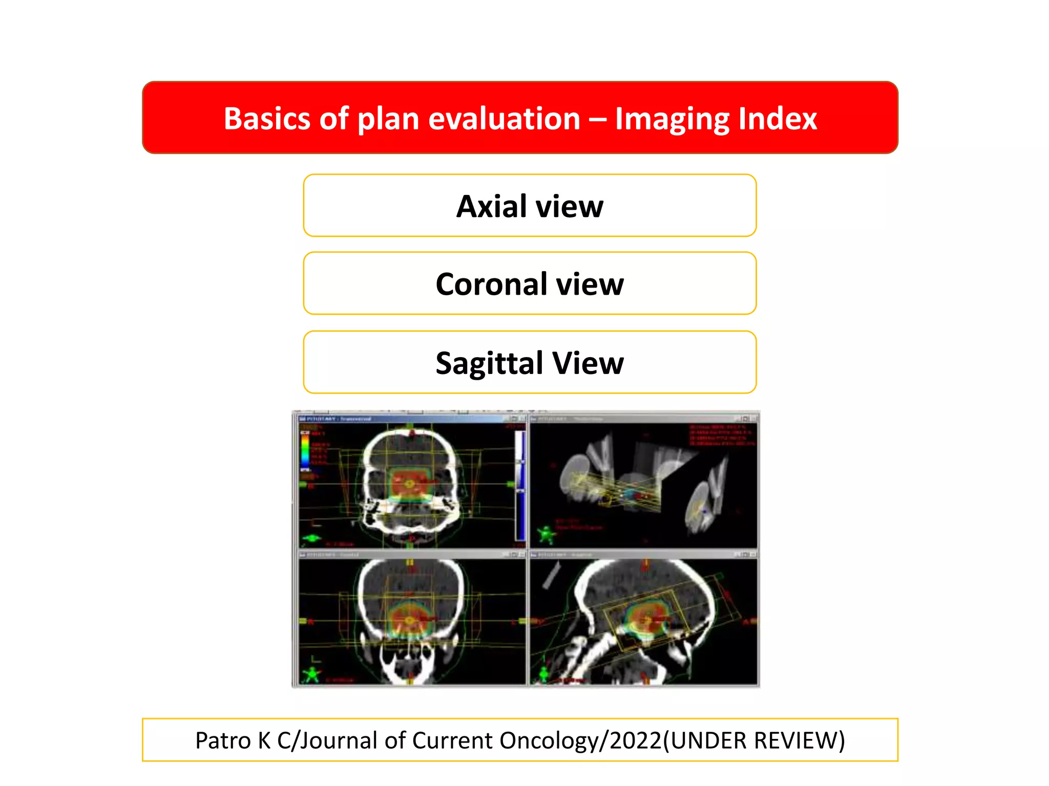 Plan evaluation in RADIOTHERAPY | PPTX