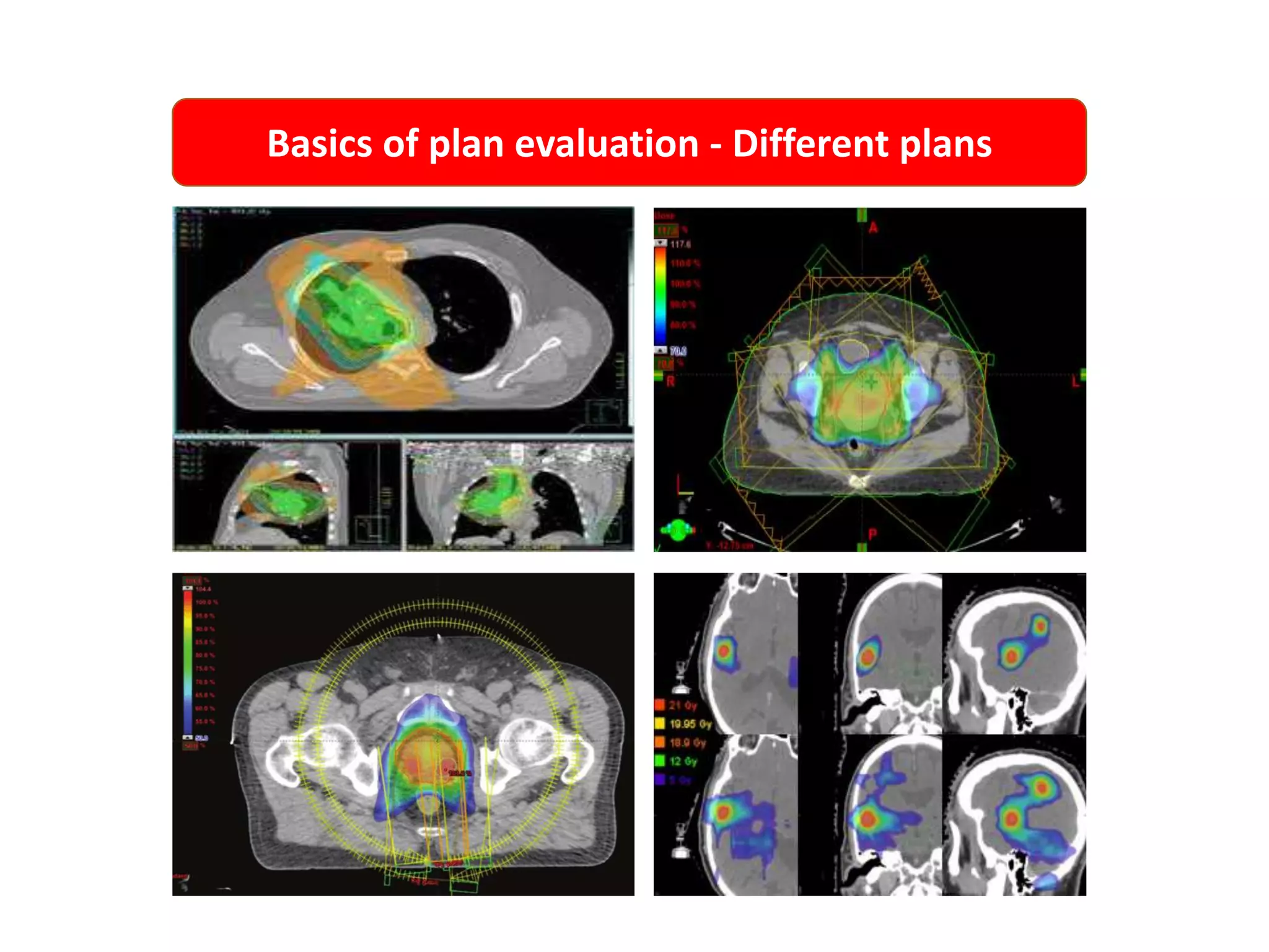 Plan evaluation in RADIOTHERAPY | PPTX