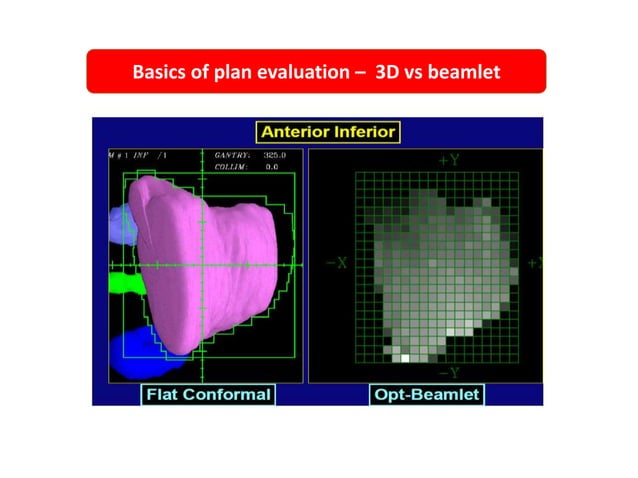Plan evaluation in RADIOTHERAPY | PPTX | Cancer | Diseases and Conditions