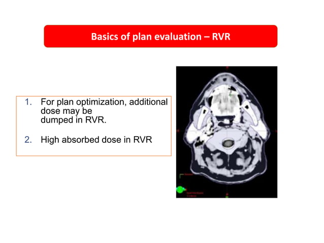Plan evaluation in RADIOTHERAPY | PPTX | Cancer | Diseases and Conditions