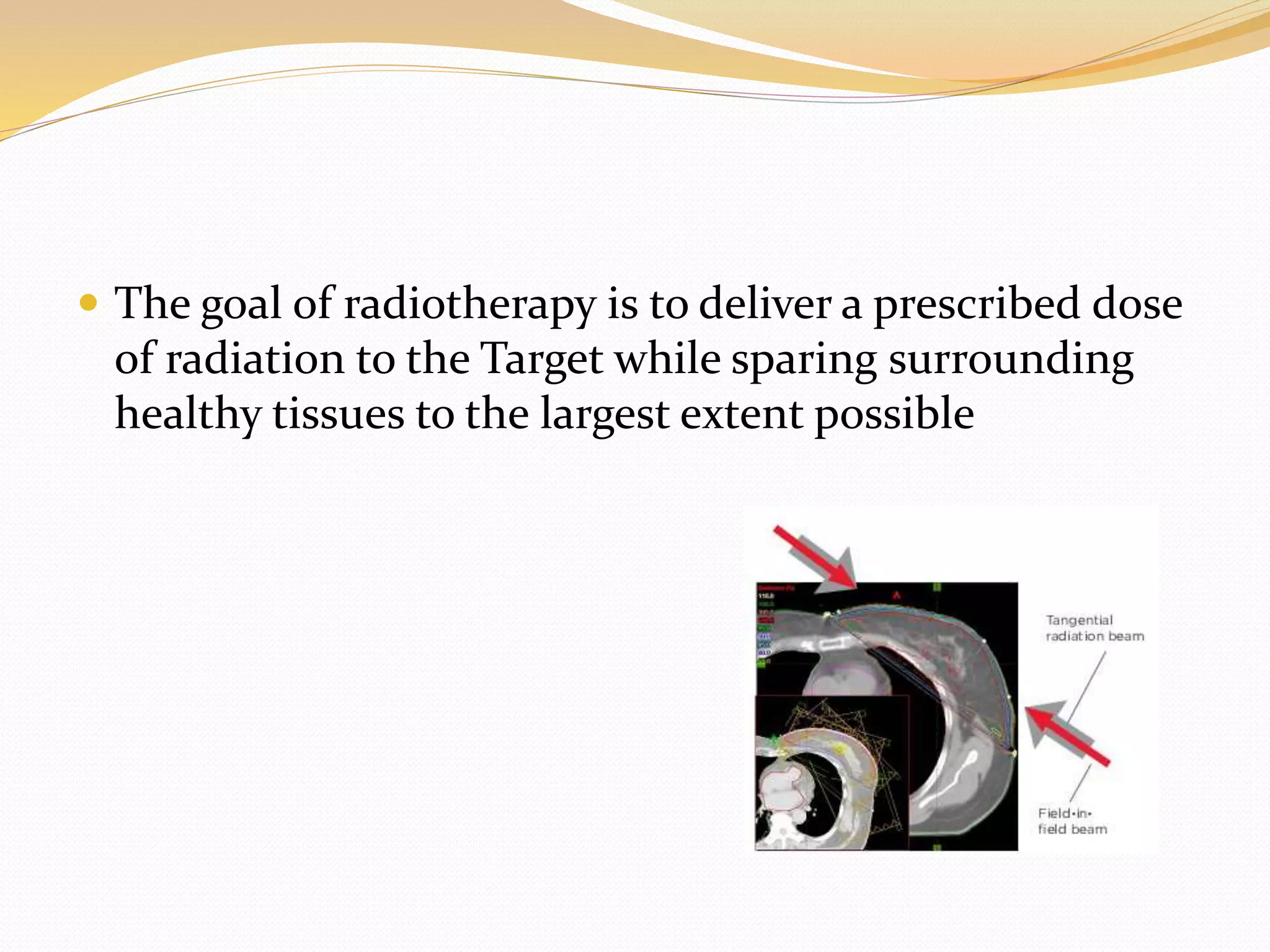 Breast Cancer Radiation Therapy: RT Plan evaluation & Recent Advances ...