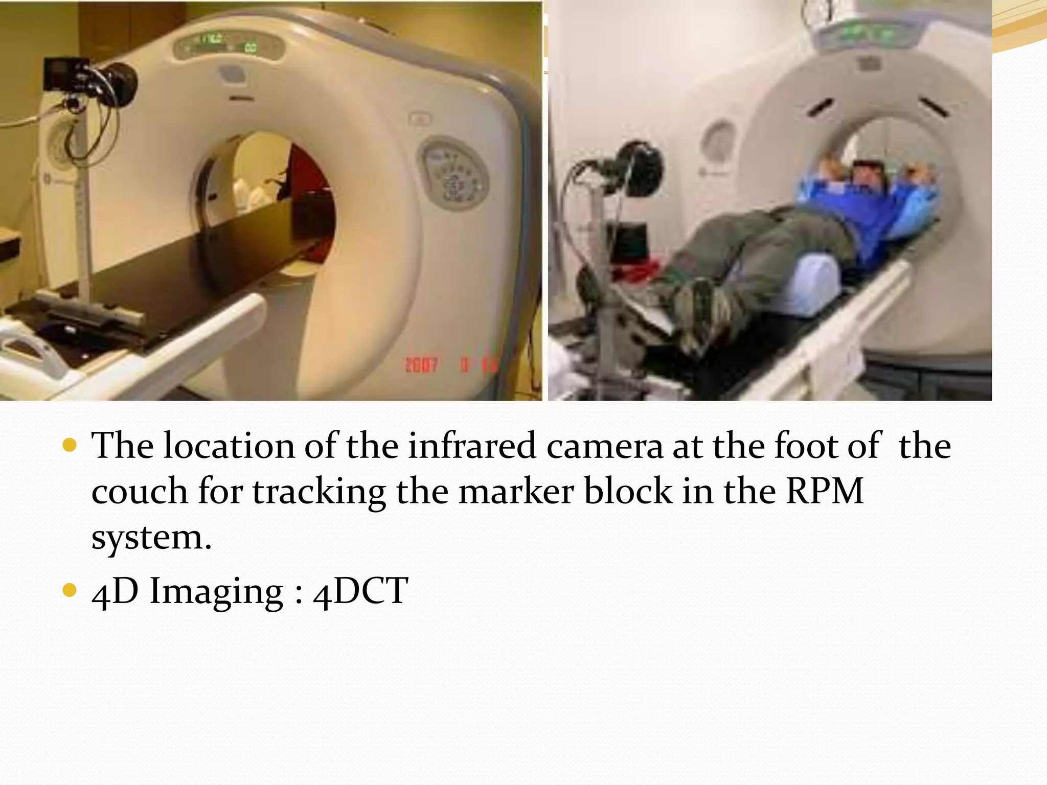 Breast Cancer Radiation Therapy: RT Plan evaluation & Recent Advances ...