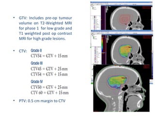 Radiotherapy plan evaluation in brain tumours | PPT