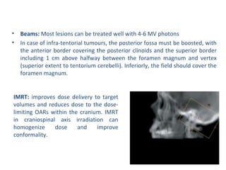 Radiotherapy plan evaluation in brain tumours | PPT