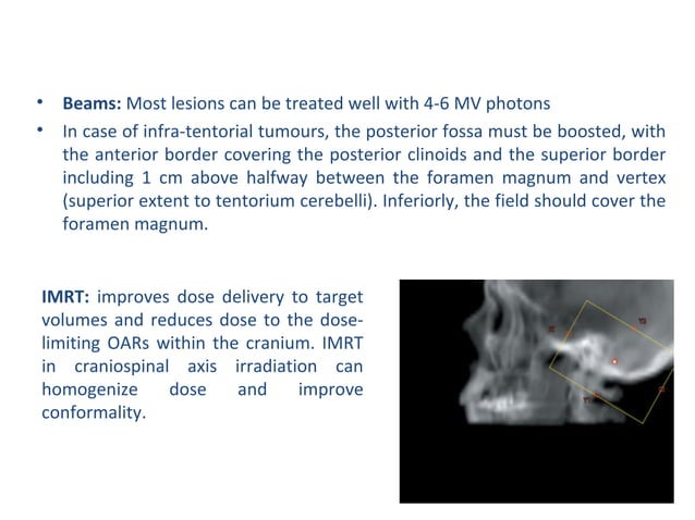 Radiotherapy plan evaluation in brain tumours | PPT | Brain and Nervous ...