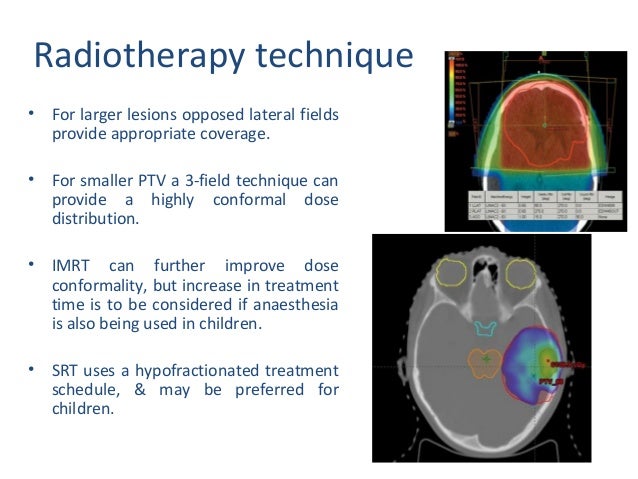 Radiotherapy plan evaluation in brain tumours