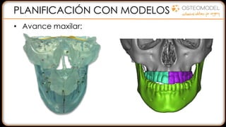 Planificación virtual y física en ortognatica | PPTX