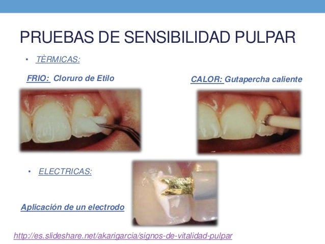 Planificacion de diagnostico en endodoncia