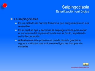 Métodos de Planificación Quirúrgicos est | PPTX