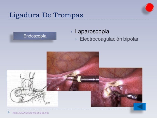 Planificacion qx pts