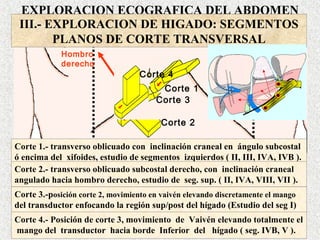 Planos de corte abdomen, riñon, prostata copia | PPT