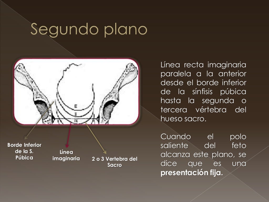 Planos De Hodge