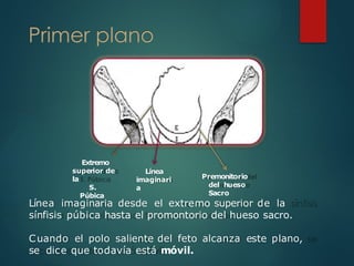 Planos de Hodge GINECOLOGIA Y OBSTETRICIA.pptx