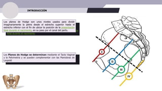 PLANOS DE HODG Y ESCALA DE DE LEE.pptx