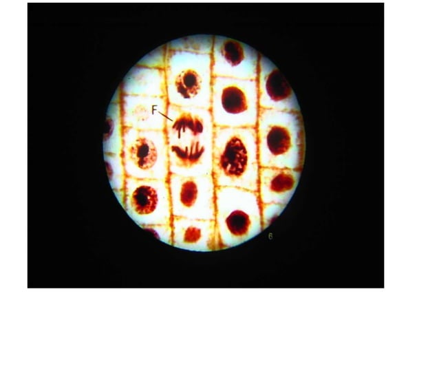 Plant & Animal Cell Mitosis Microviewer Pictures
