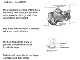 Heel Pain and Plantar Fasciitis | PPT