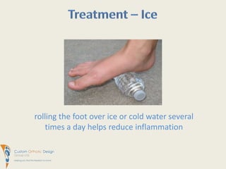 Plantar Fasciitis - a pain in the foot | PPTX