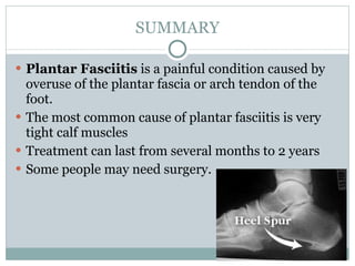 Plantar fasciitis | PPT