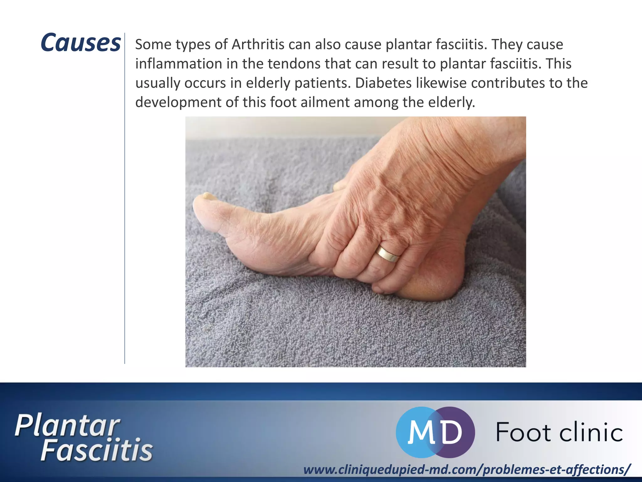 Plantar Fasciitis : Origin, Causes, Examination, Treatment of plantar ...