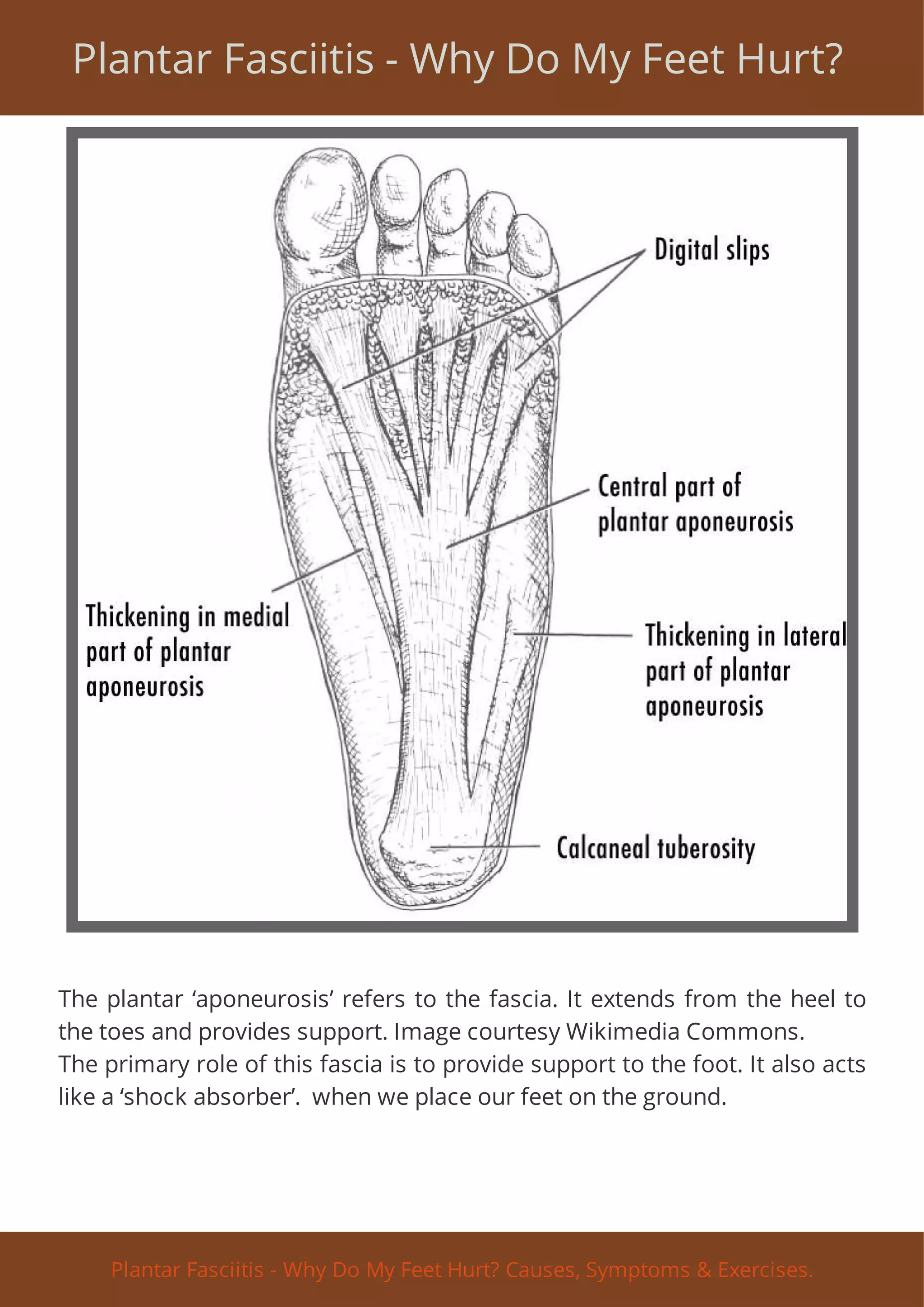 Plantar fasciitis - A Simple Patient Guide by Dr Vivek Baliga ...