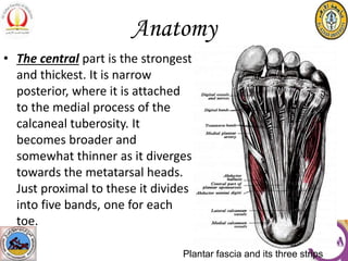Plantar fasciitis | PPT