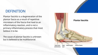 PLANTAR FASCIITIS or PLANTER HEEL PAIN.pptx