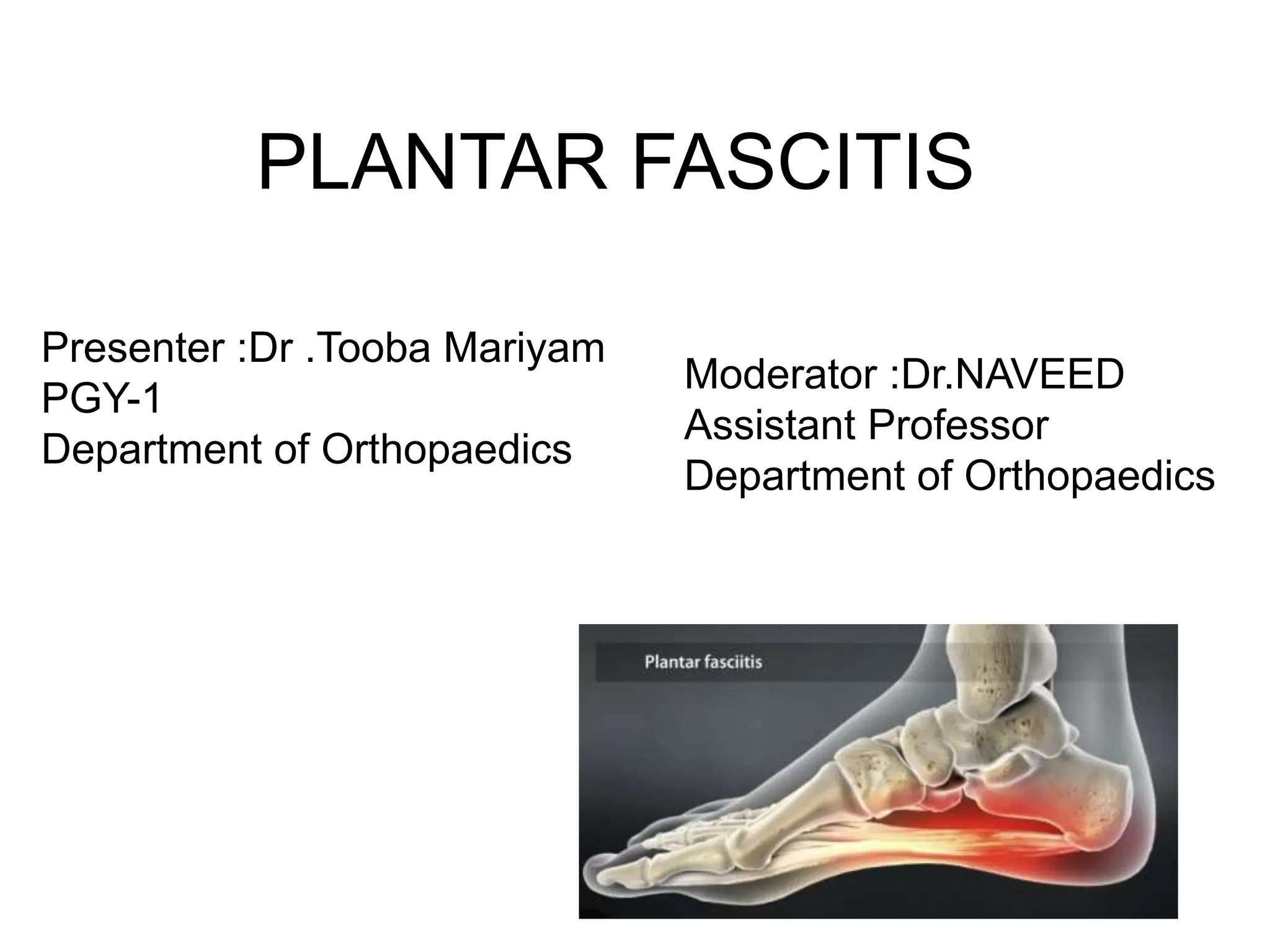 plantar fascitis.pptx management and clinical features | PPTX