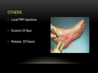 Plantar fascitis, fibrositis | PPTX