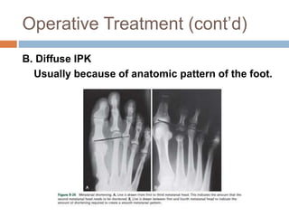 Plantar keratosis | PPTX