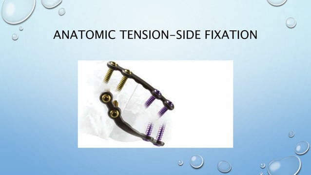 Plantar Python | PPT