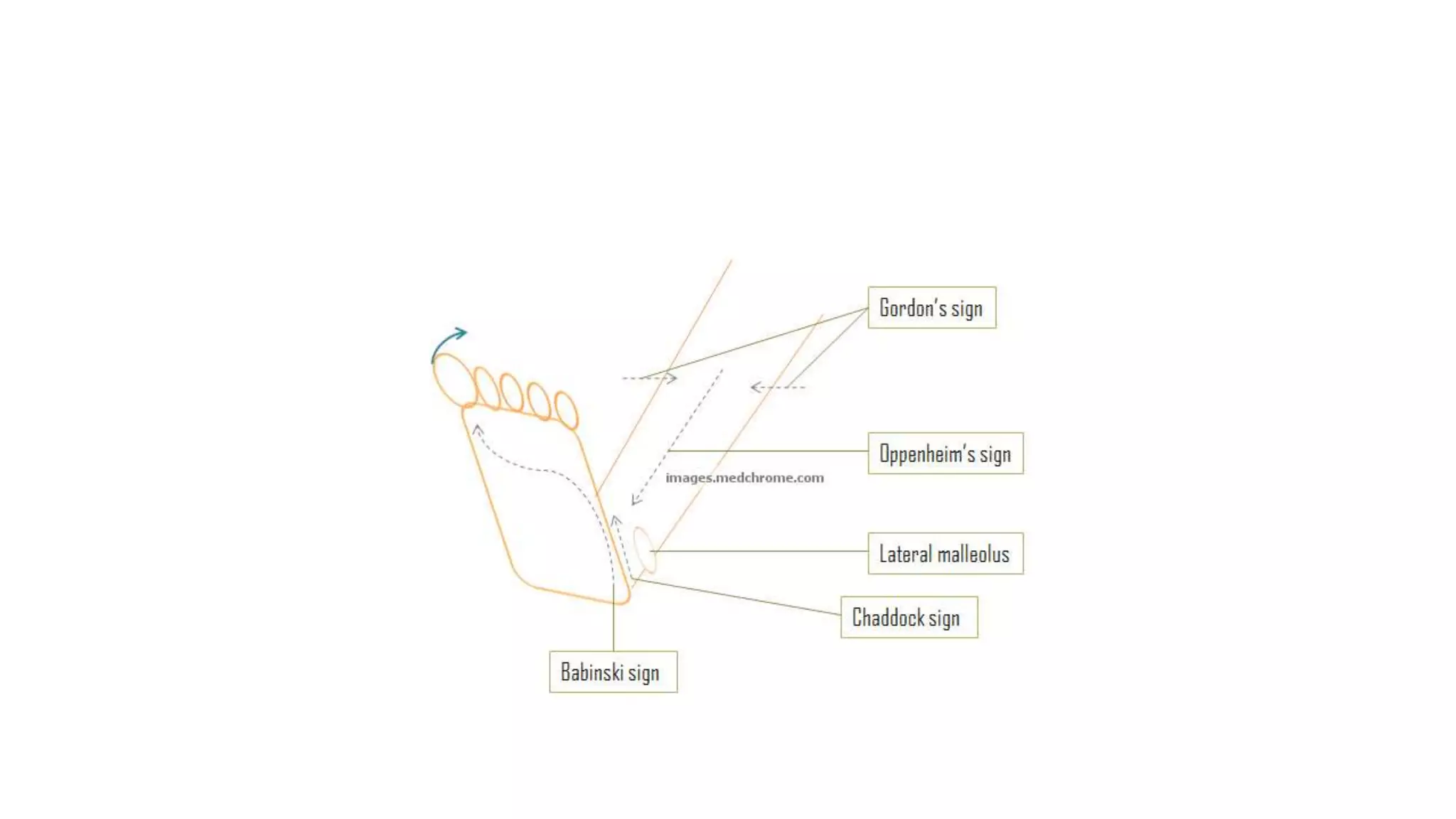 Plantar reflex | PPTX