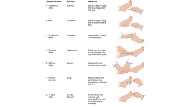 Plantar reflex | PPTX