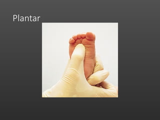 Plantar Reflexes and babinski sign for neurological patients | PPTX