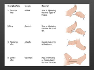 Plantar Reflexes and babinski sign for neurological patients | PPTX