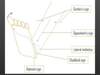 Plantar Reflexes and babinski sign for neurological patients | PPTX